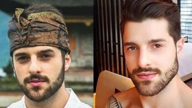 Alok vira o novo desejo dos homens após procedimento estético e valor ...