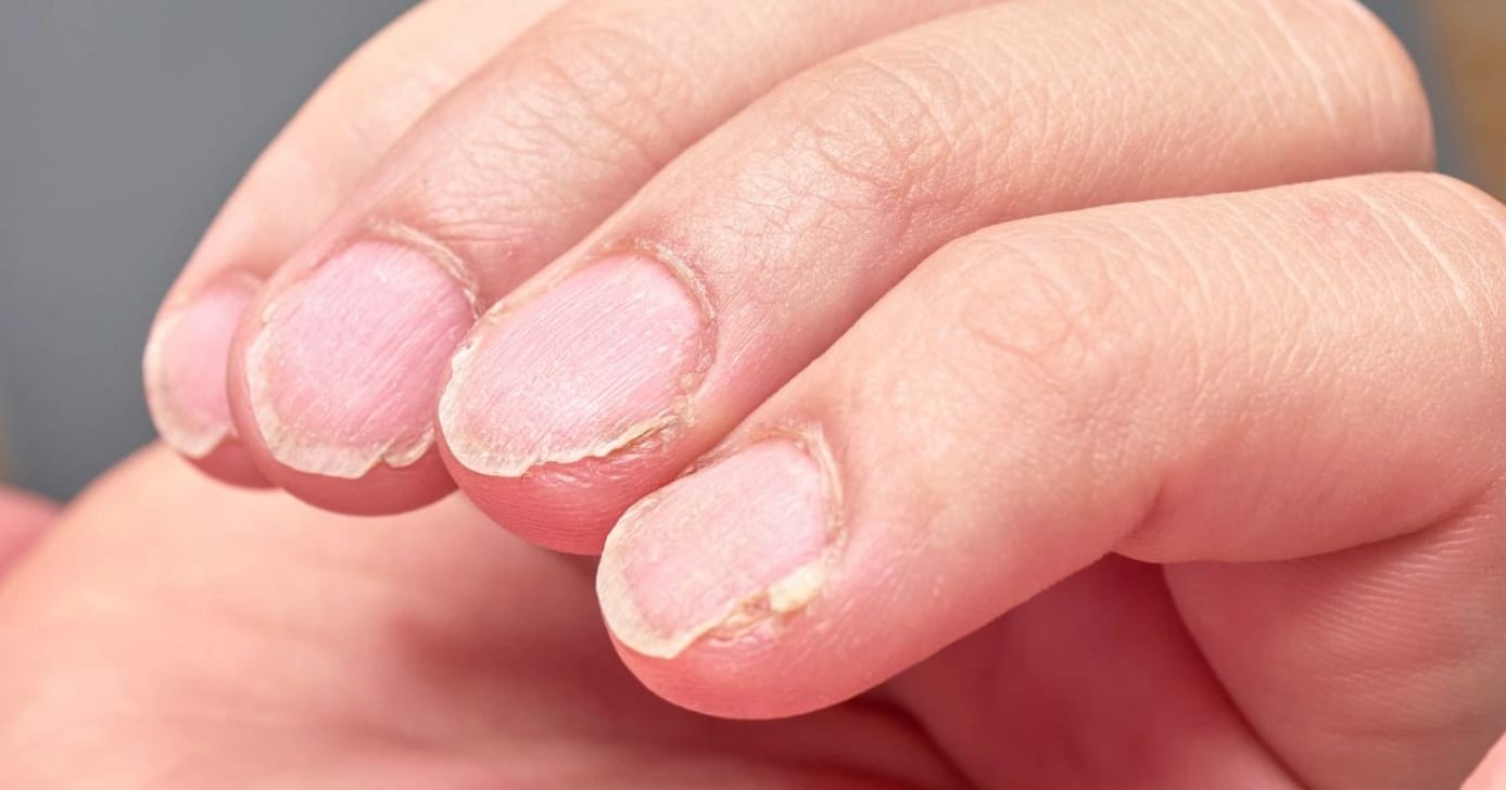 Destroem suas unhas: 4 hábitos terríveis para eliminar da sua vida hoje